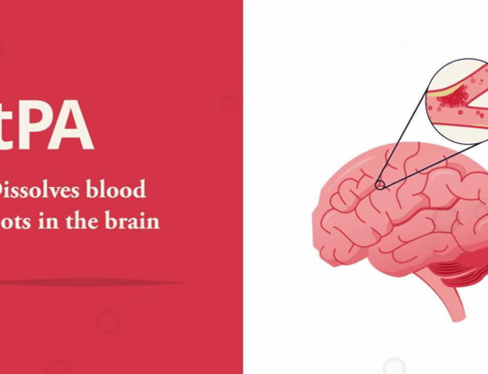 Aphasia and Stroke - Stroke Awareness Foundation